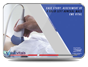 Case Study: Assessment of a Solid Left Adnexal Mass