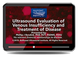 Ultrasound Evaluation of Venous Insufficiency and Treatment of Disease